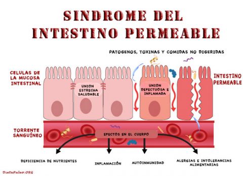 Permeabilidad intestinal - Marta Mato